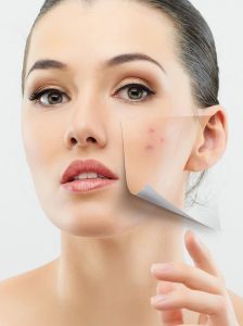 Tratamiento Anti Acné-VIT • Elements Spa